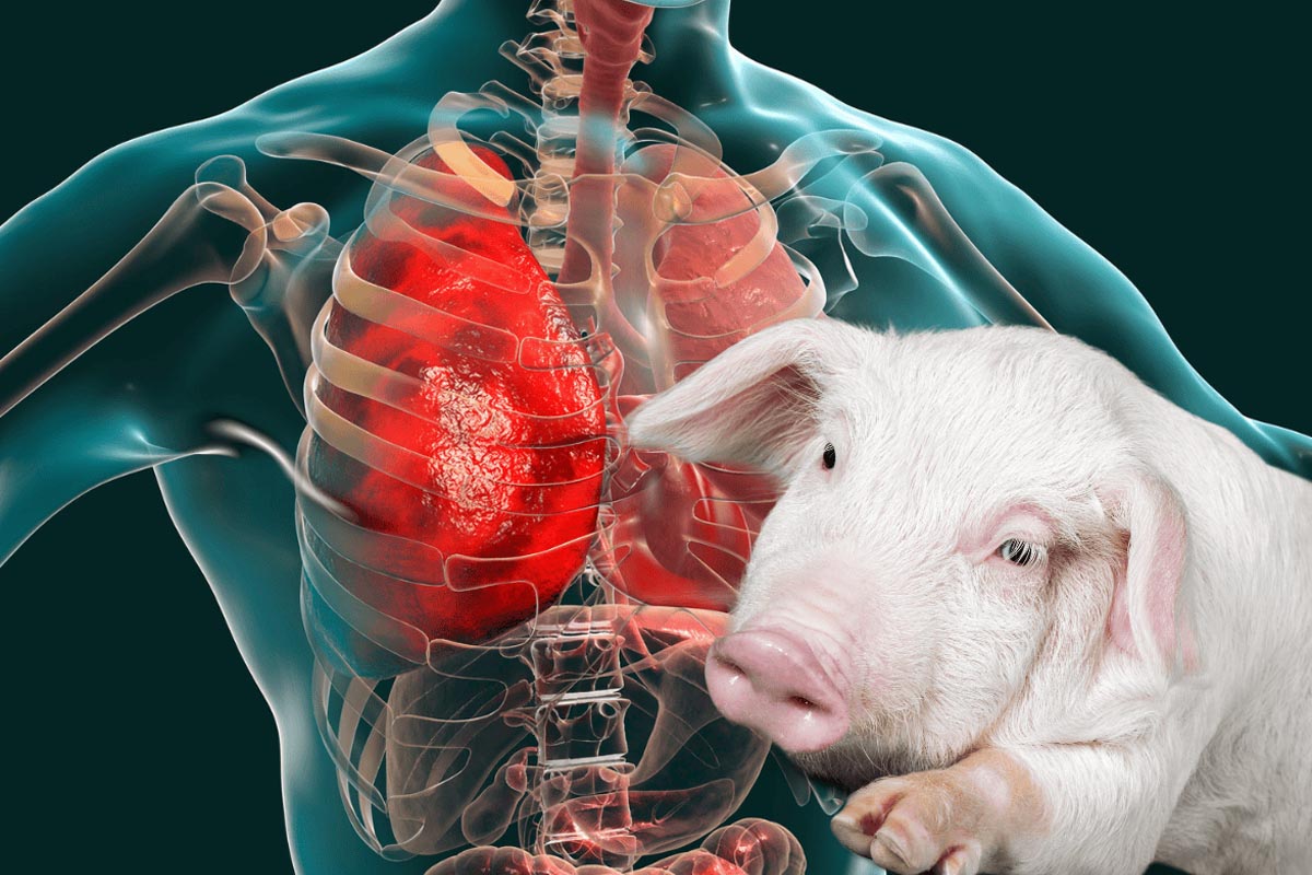 China reporta primer trasplante exitoso de pulmón de cerdo en cuerpo ...